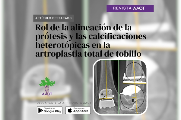 Artículos destacados – Rol de la alineación de la prótesis y las ...